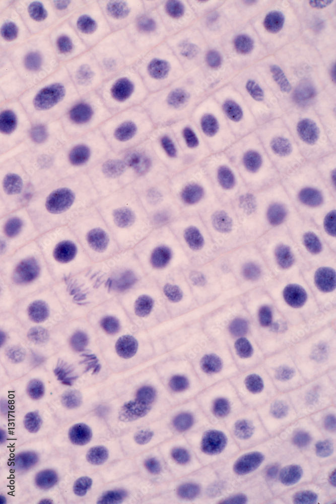 Root tip of Onion and Mitosis cell in the Root tip of Onion under a ...