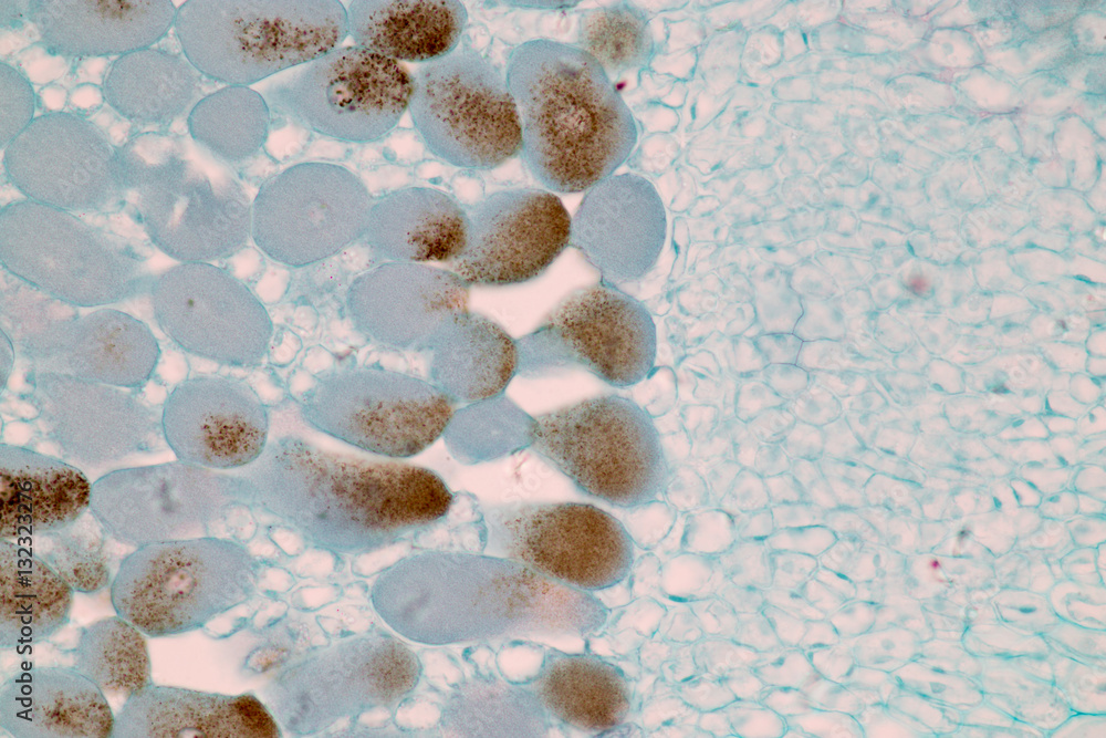 Mycorrhiza and Nitrifying bacteria on the slide under microscope view ...