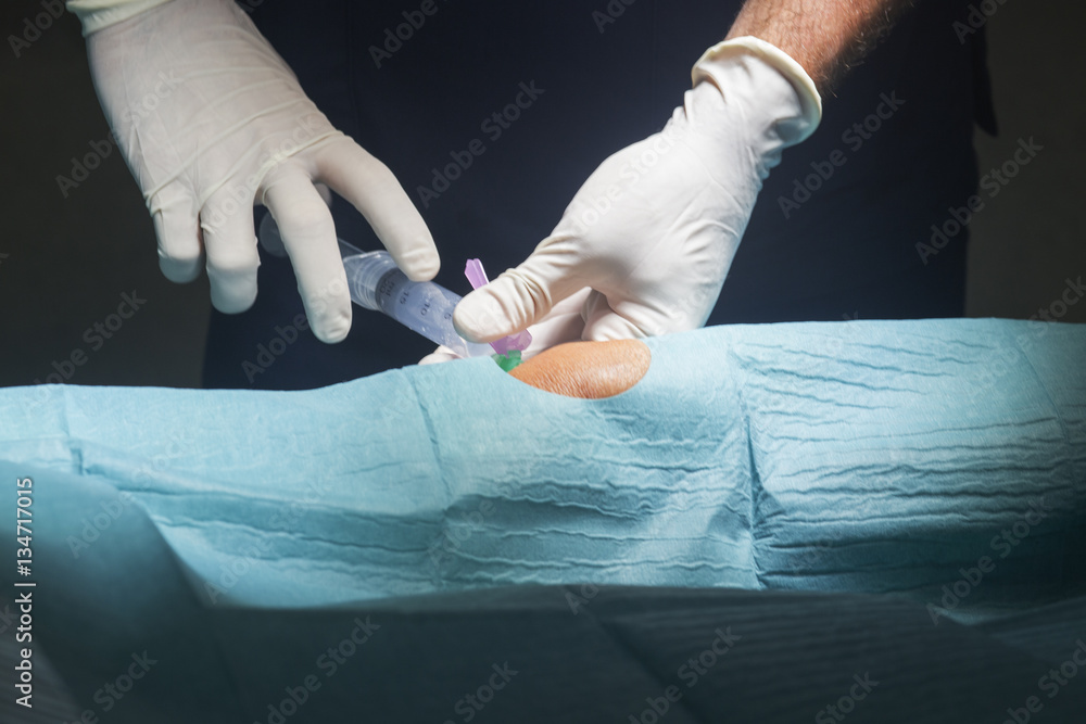 Knee surgery anaesthetic injection Stock Photo | Adobe Stock