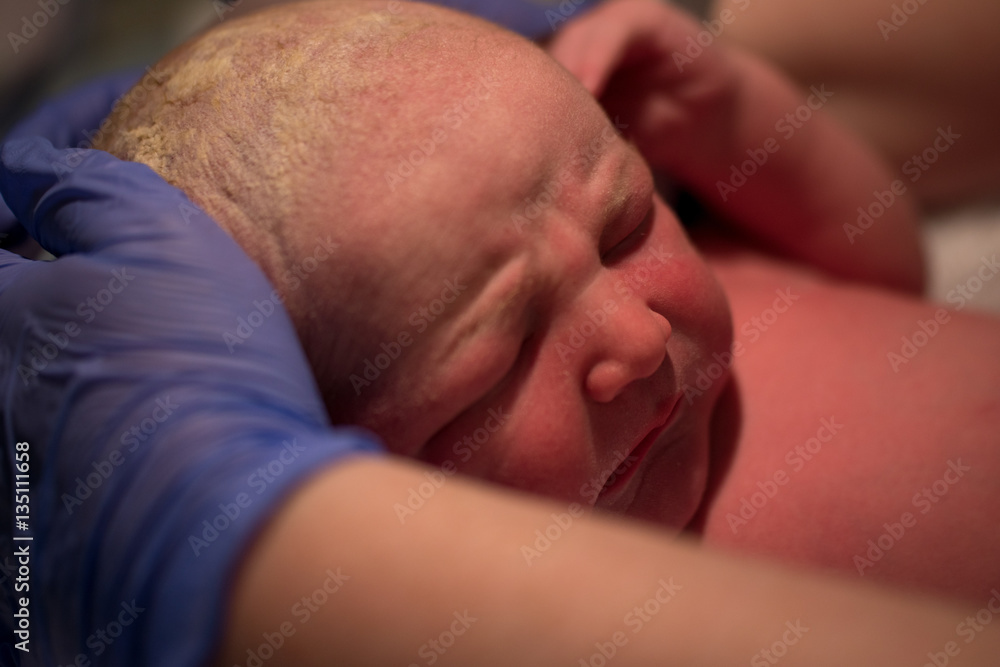 Newborn baby being closely examined by paediatric doctors moments after ...