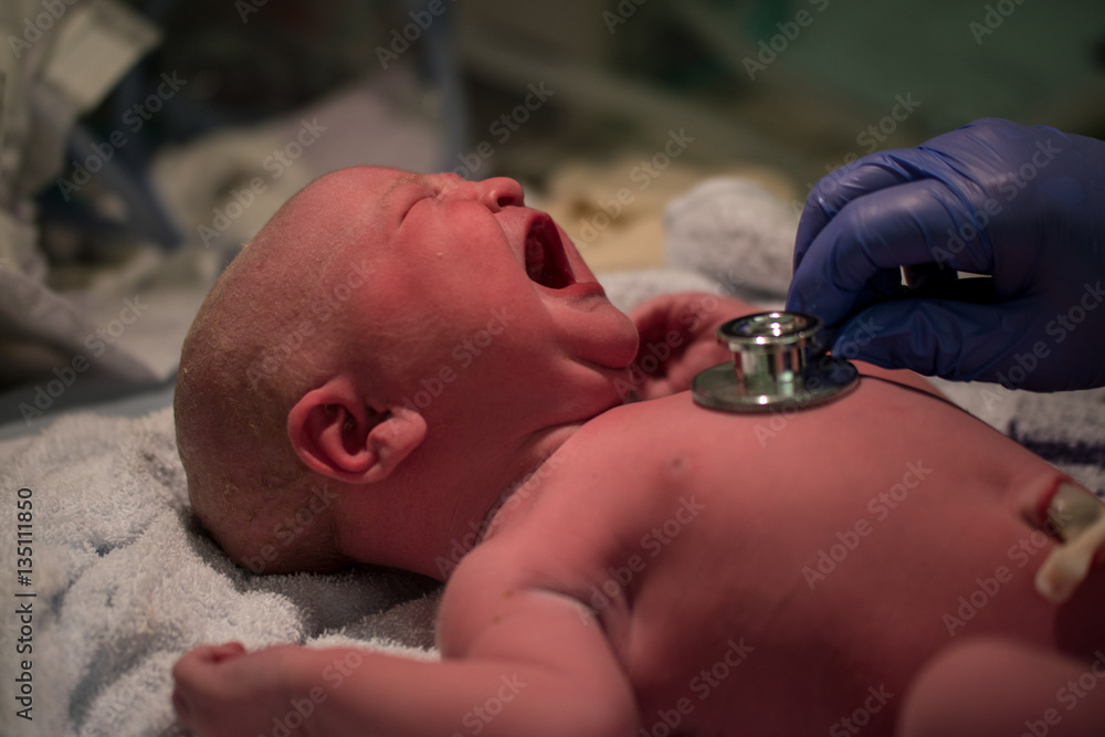 Newborn baby being examined by paediatric doctors moments after birth ...