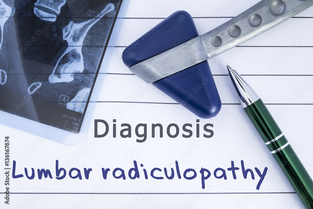 Diagnosis of Lumbar radiculopathy. Medical health history written with ...