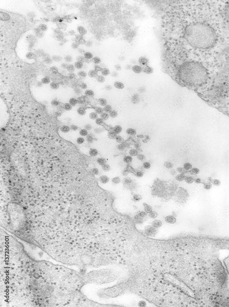 Foto stock di Negatively-stained transmission electron micrograph of ...