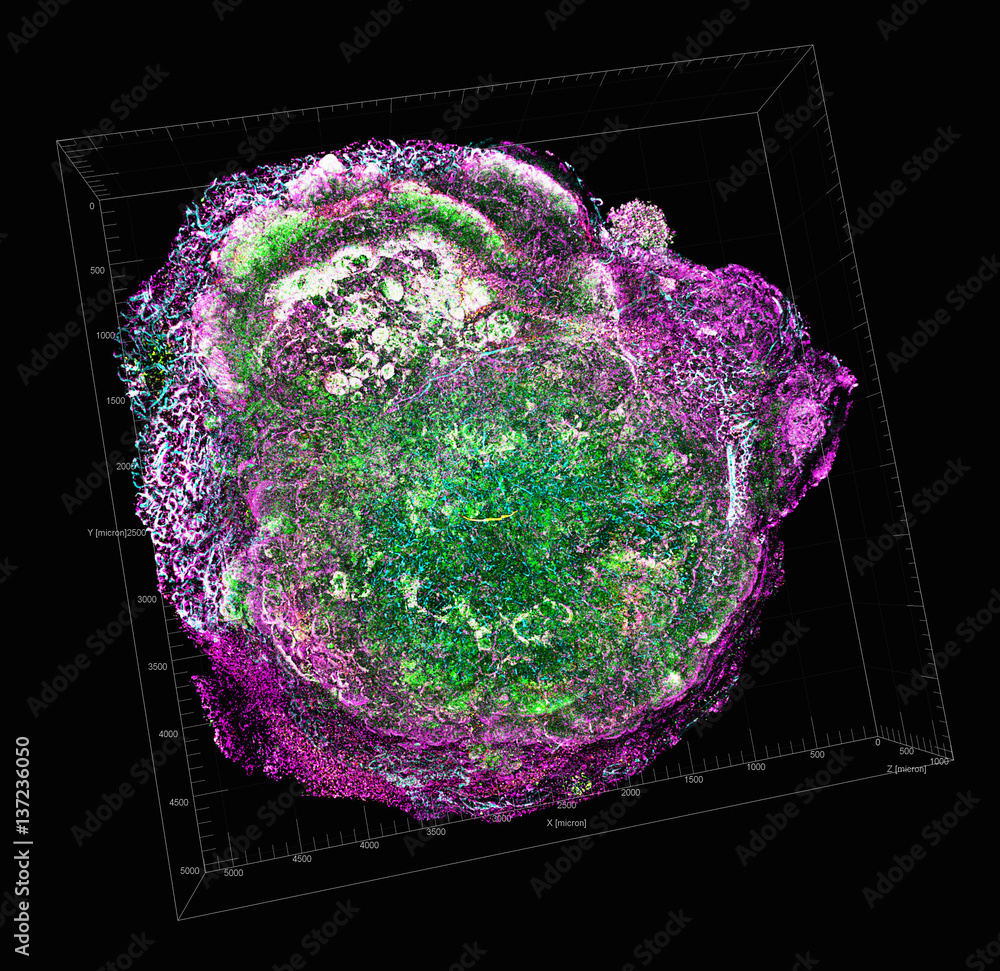 Transparent tumor tomography visualising tumor microenvironment ...