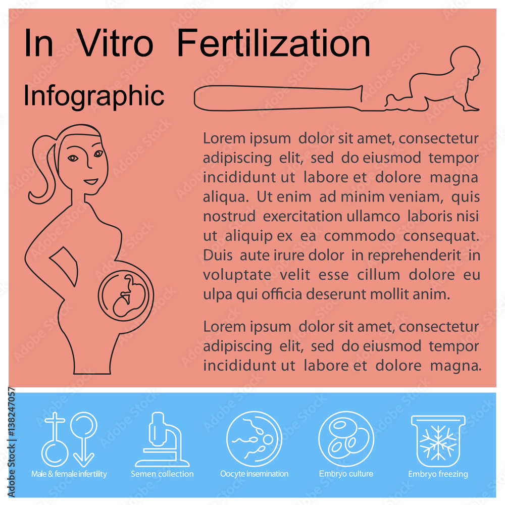 In vitro fertilization infographic. Illustration showing egg retrieval ...