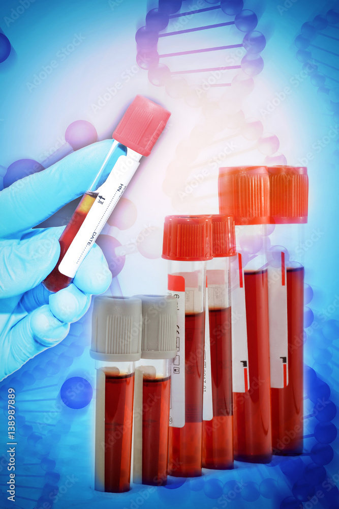 DNA testing of the blood in the laboratory and blood sample collection ...