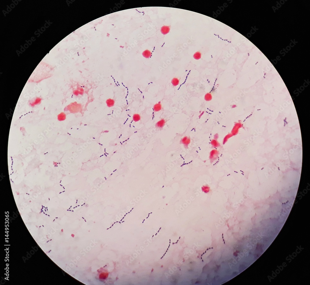 Foto de Stock Smear of human blood culture Gram's stained with gram ...