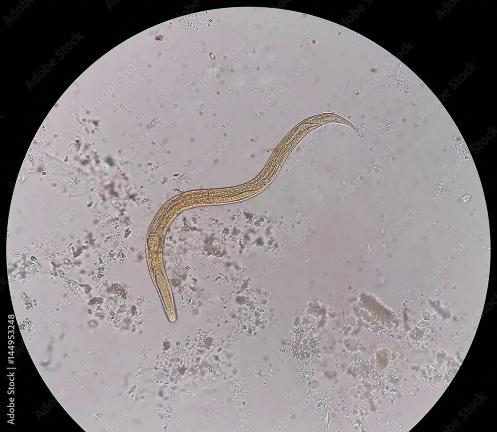 Parasite in stool under 40X light microscopy; Strongyloides stercoralis ...