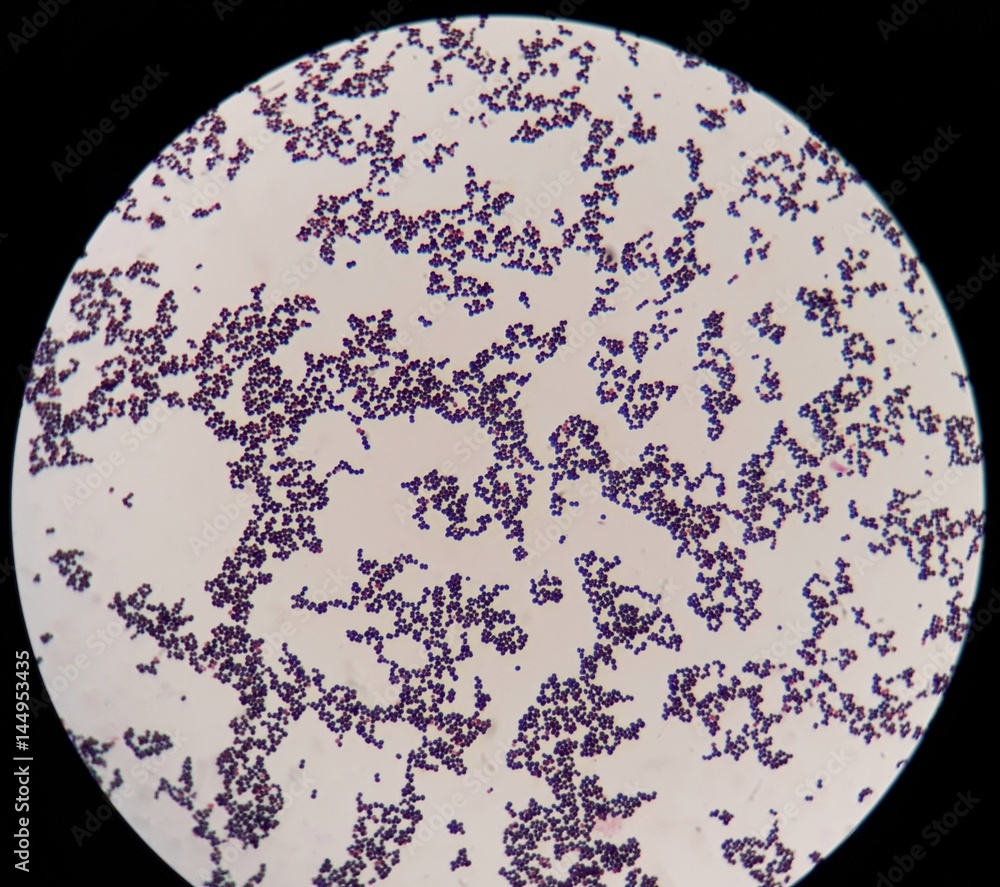 Smear of gram positive cocci bacteria under 100X light microscope ...