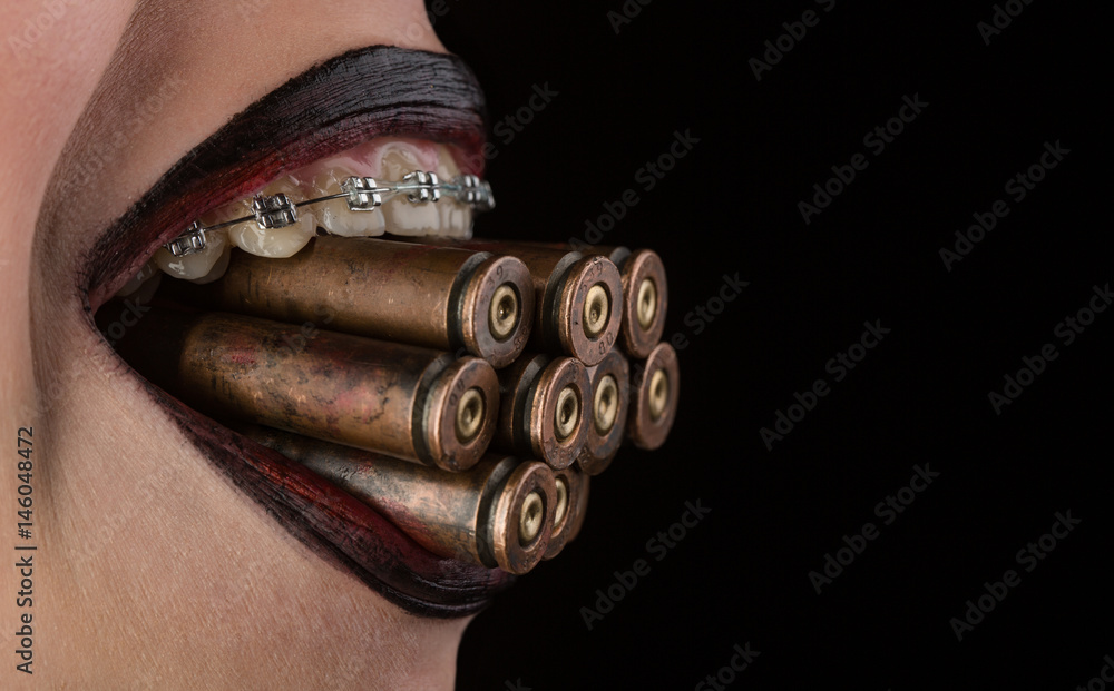 Bullets from revolver or hand pistol between teeth with braces ...