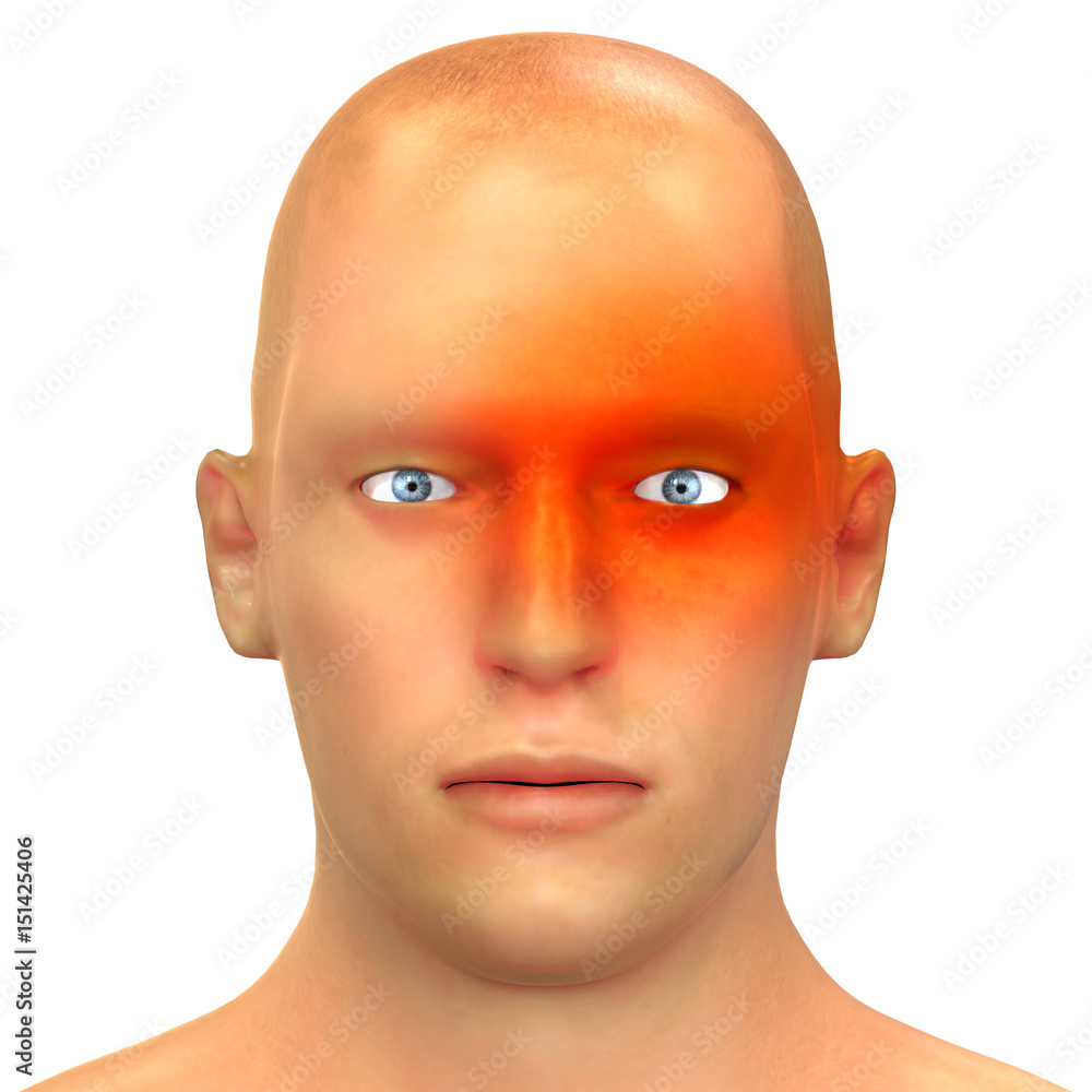 Human Headache Types of Anatomy (Cluster) Stock Illustration | Adobe Stock