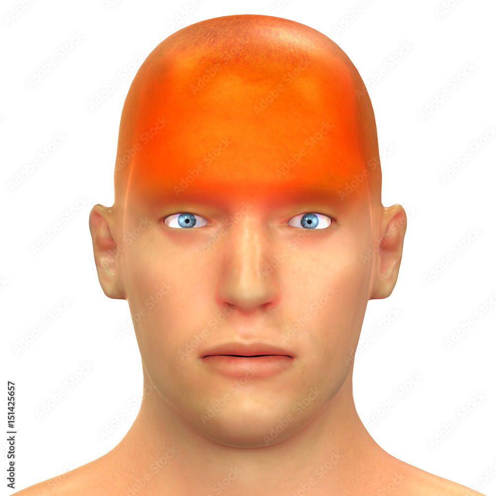 Human Headache Types of Anatomy (Tension) Stock Illustration | Adobe Stock