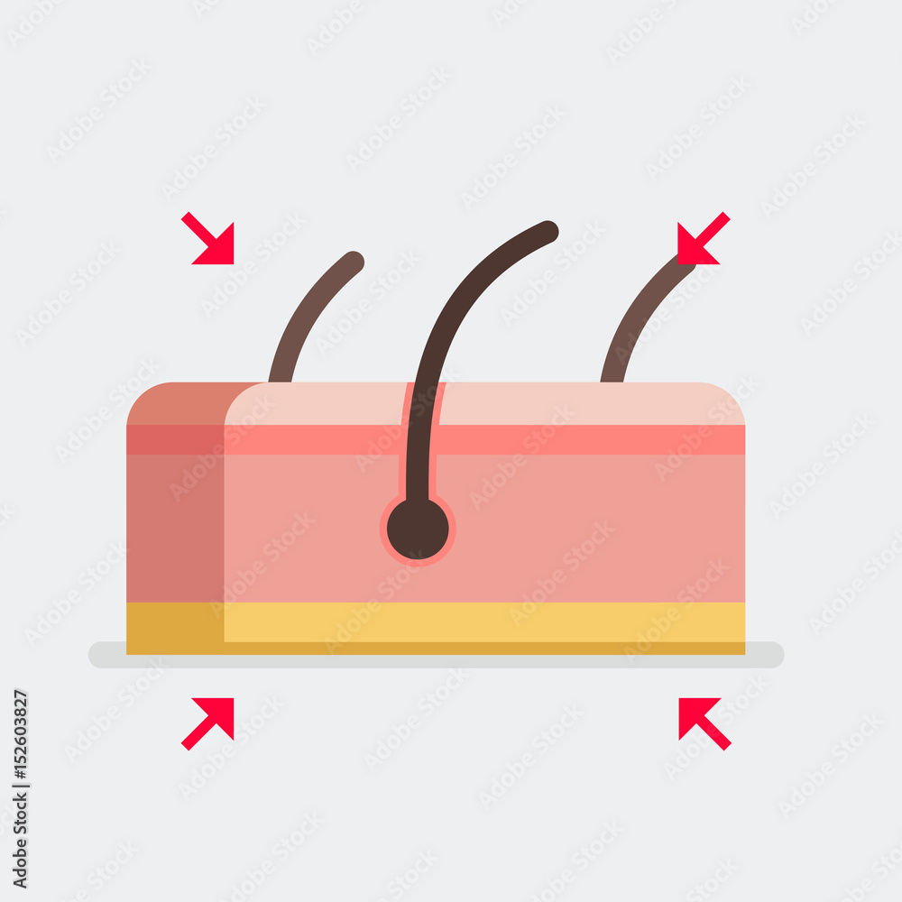 Skin vector illustration Stock Vector | Adobe Stock