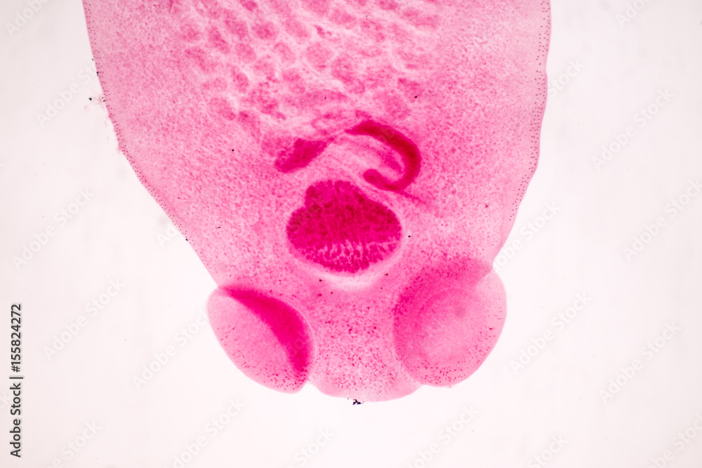 Flukes infestation (parasite) under microscope view. Stock Photo ...