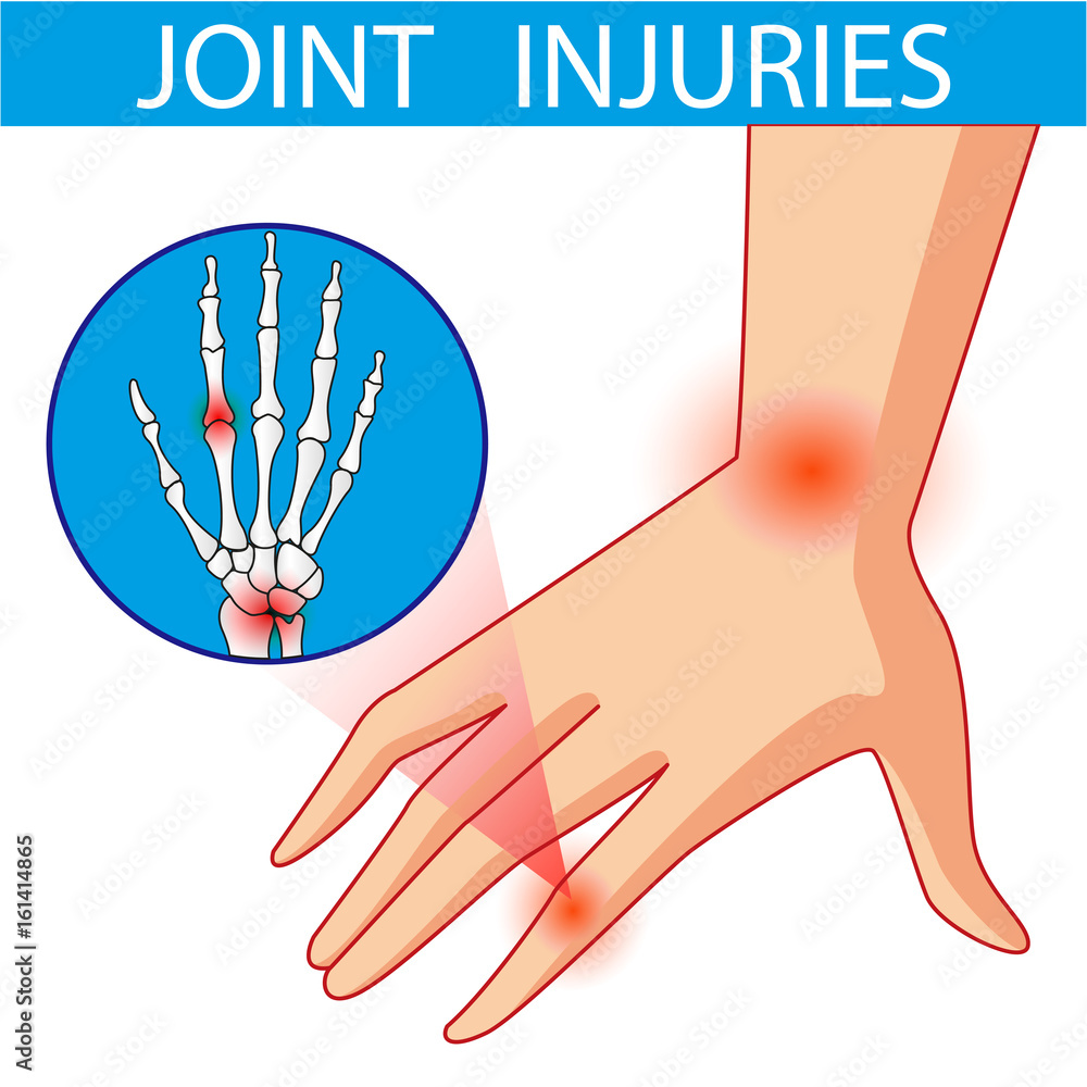 Joint pain. Cartoon vector illustration. Stock Vector | Adobe Stock