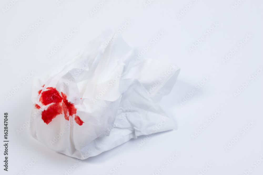 Wound blood, blood on tissue paper on white background. Nosebleed or ...