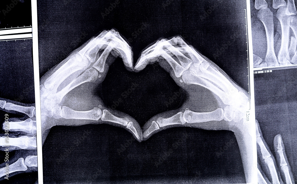 X-ray image of hands making heart symbols. Stock Photo | Adobe Stock