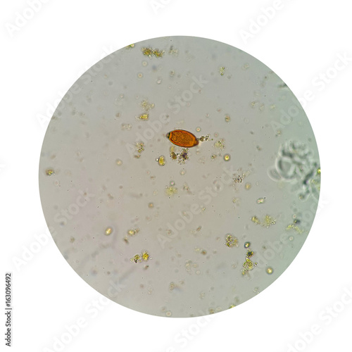 Stool parasites examination test for parasites or eggs in a human stool ...