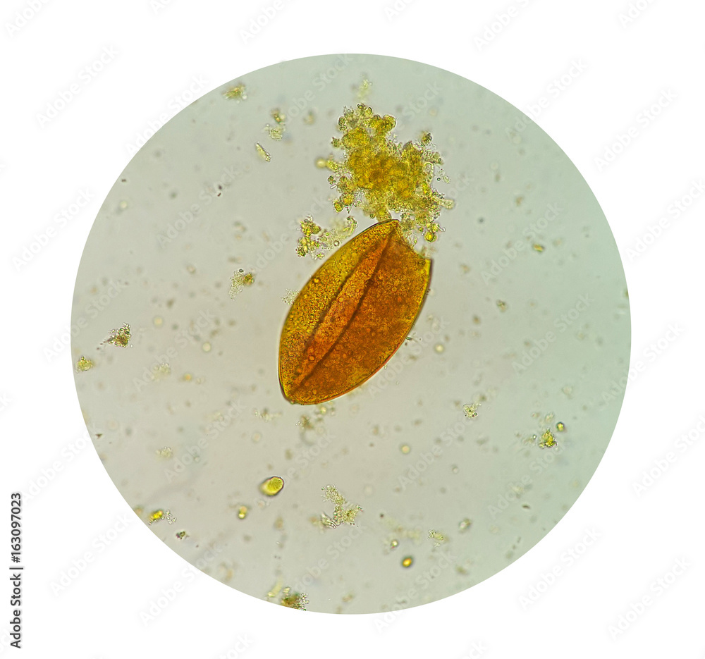 Stool parasites examination test for parasites or eggs in a stool ...