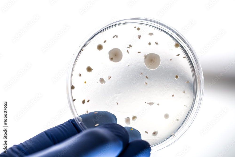 Hand showing dangerous bacteria on agar culture Stock Photo | Adobe Stock