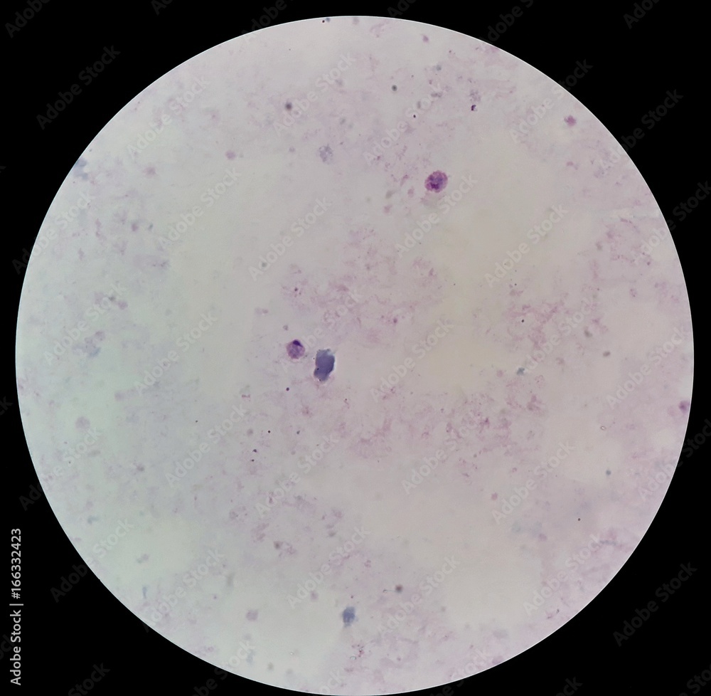 Under 100X light microscope, human parasite on thick film of blood ...
