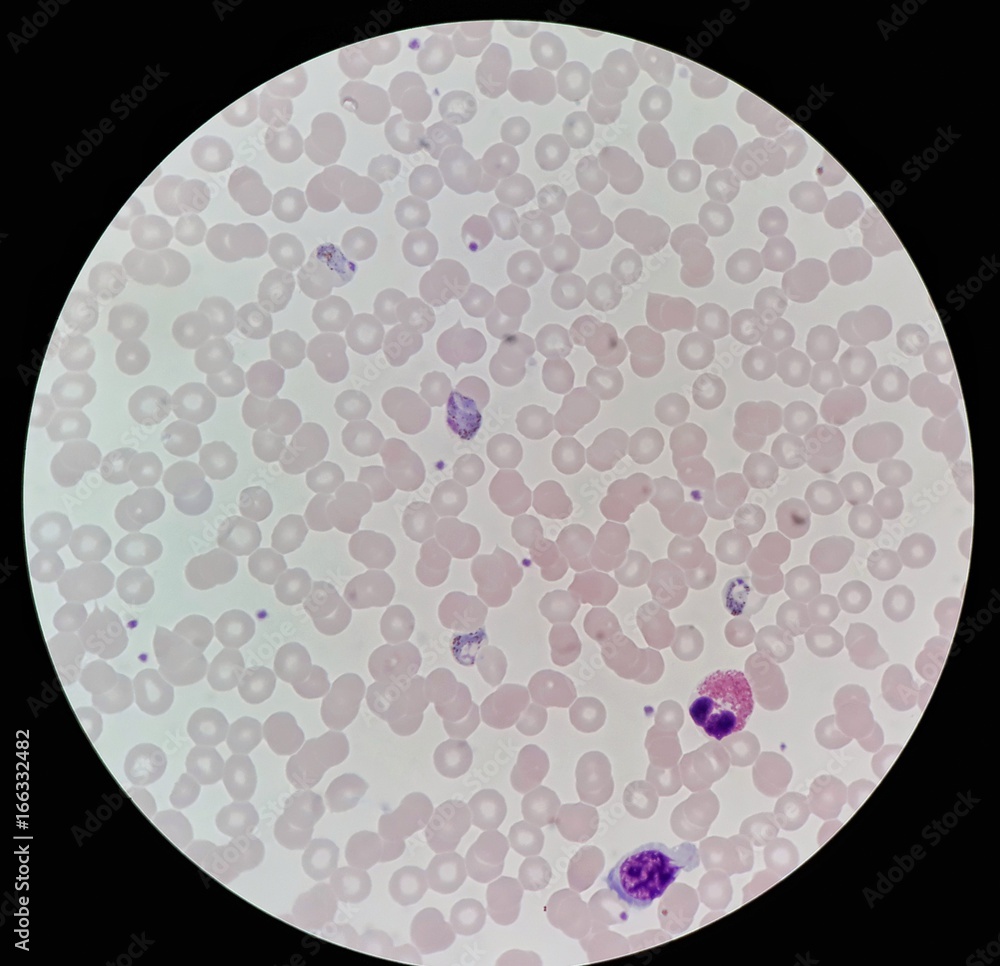 Under 100X light microscope, human parasite on thin film of blood smear ...