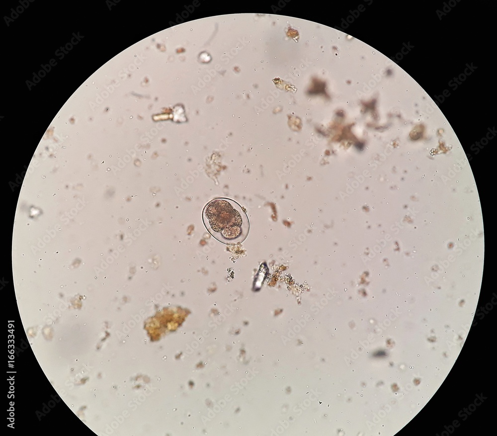 Hookworm egg in stool examination, under 40X light microscope. Stock ...