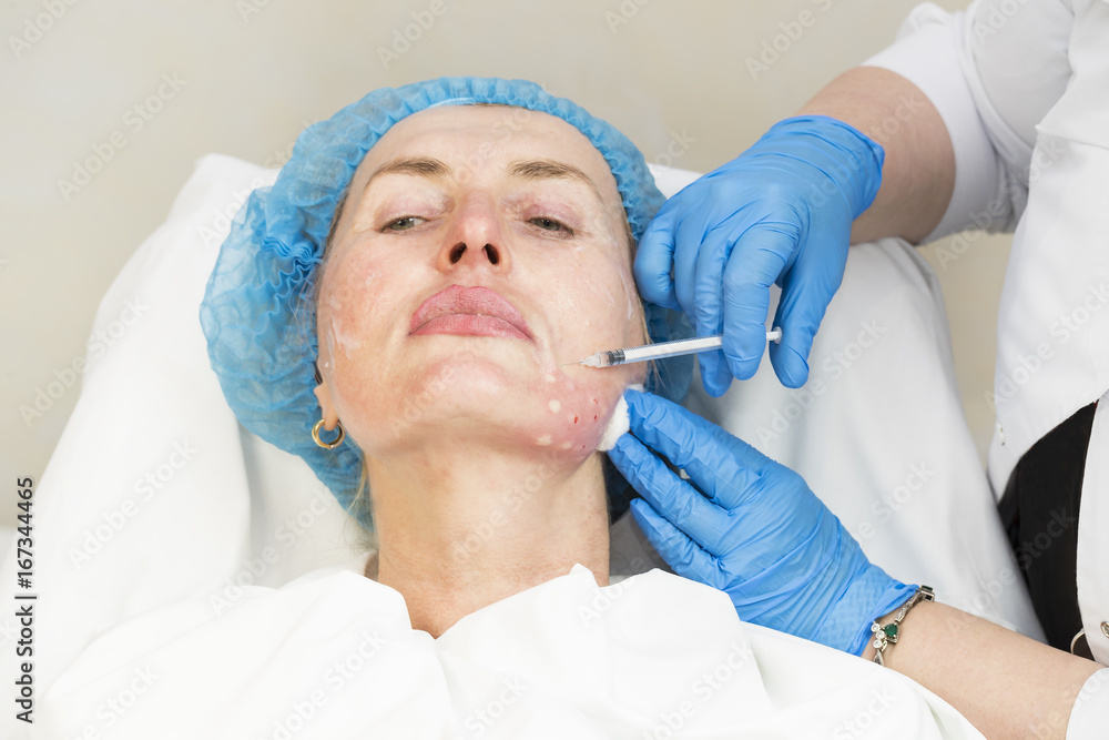 Cosmetic treatment with injection in a clinic Stock Photo | Adobe Stock