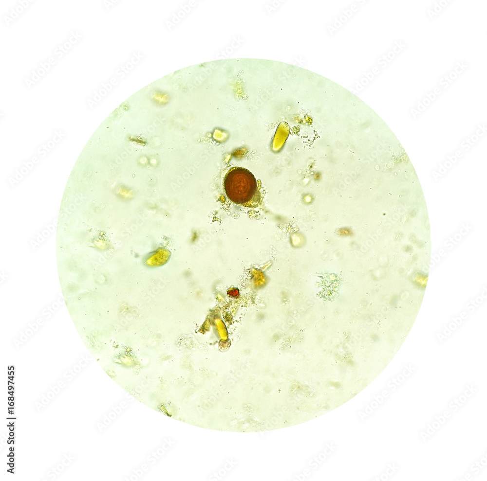 Stool parasites examination test for parasites or eggs in human stool ...