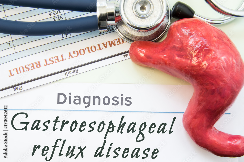 Model of stomach, blood test and stethoscope lying near title diagnosis ...