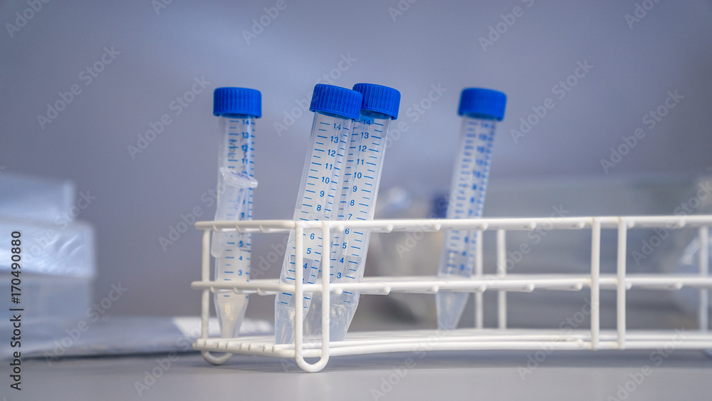 Laboratory work. Tubes for cell splitting at the sterile bank. Stock ...