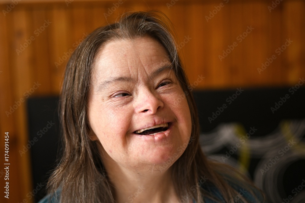 portrait of young adult woman with down syndrome Stock Photo | Adobe Stock