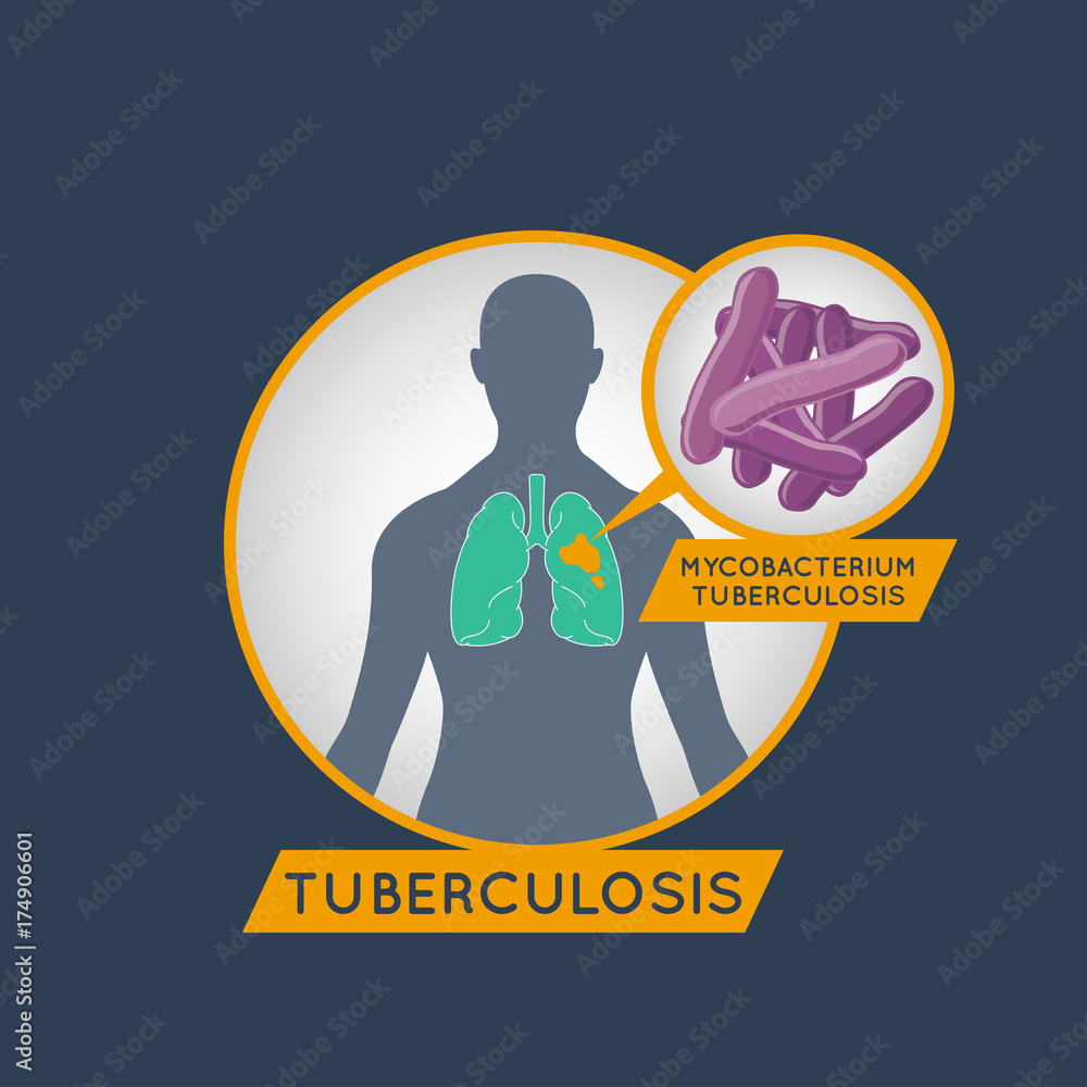 TUBERCULOSIS vector logo icon illustration Stock Vector | Adobe Stock