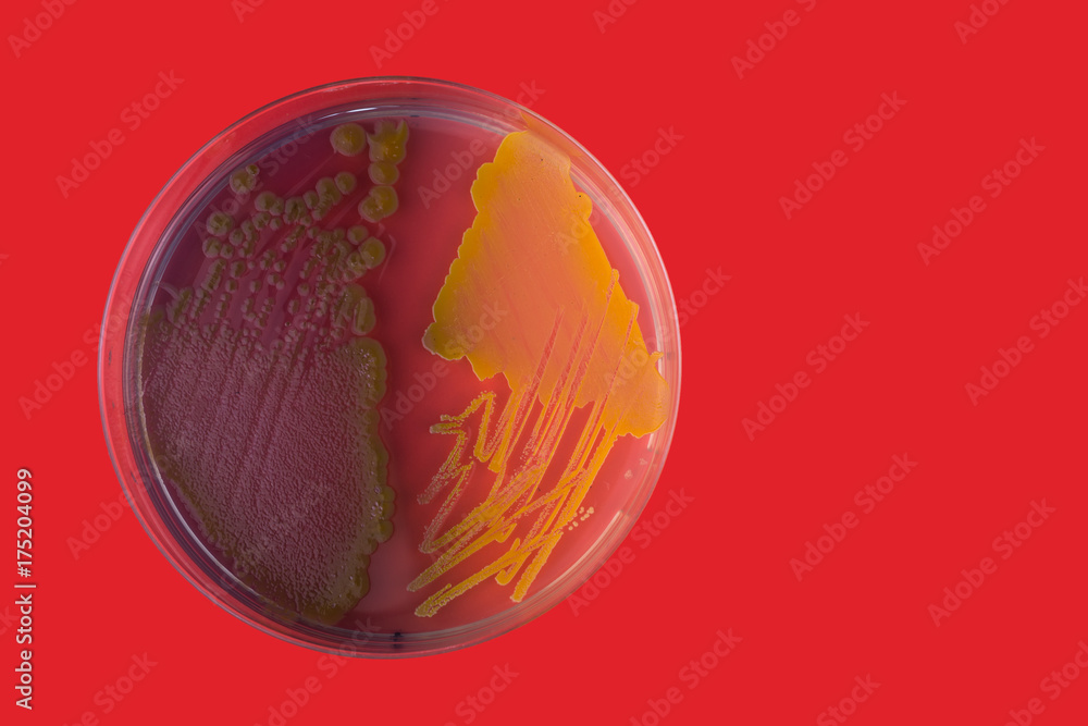 Petri dish with bacteria on red background. Staphylococcus aureus and ...