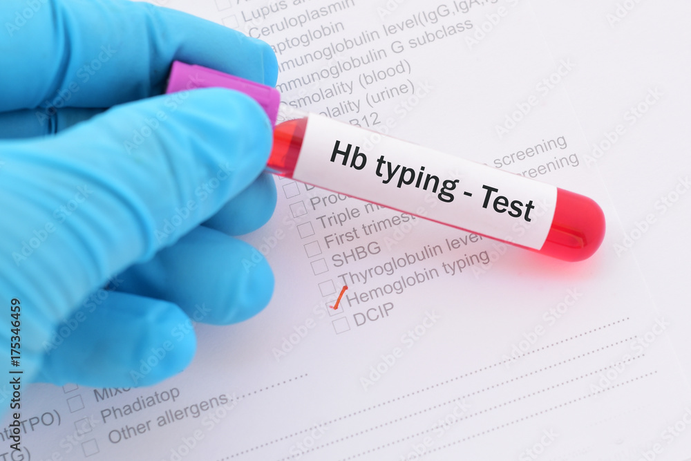 Blood sample with requisition form for hemoglobin typing test ...