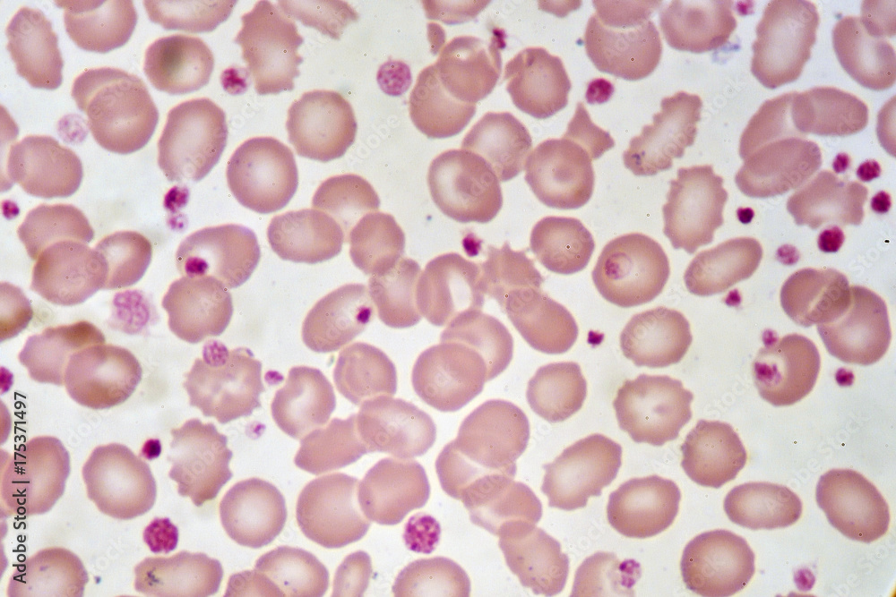 Red blood cells and platelet in blood smear Stock Photo | Adobe Stock