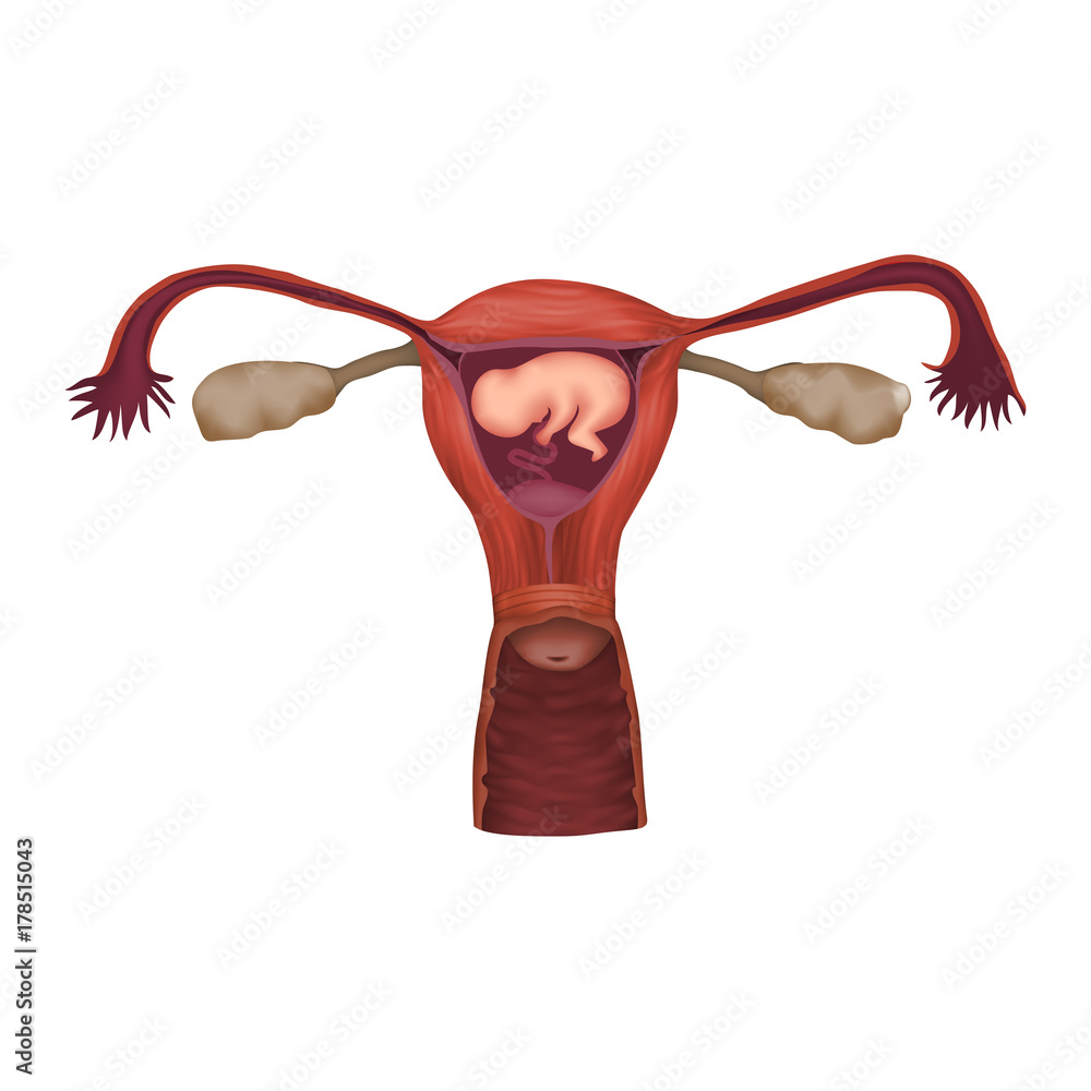 Placenta previa. Embryo, fetus in uterus, placenta, umbilical cord ...