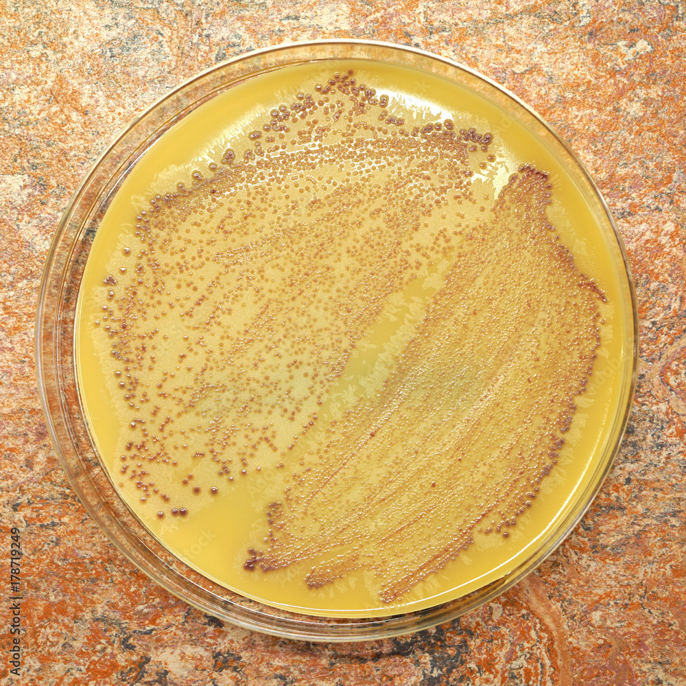 Foto de Stock MRSA test on plate. | Adobe Stock