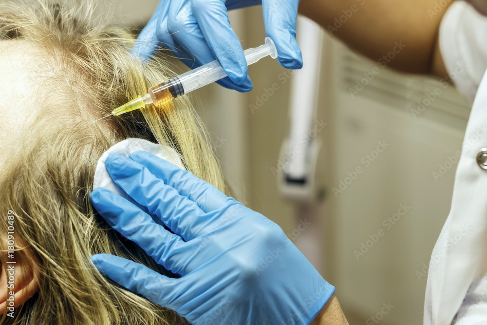 The procedure for treating hair from falling out by injection. The ...