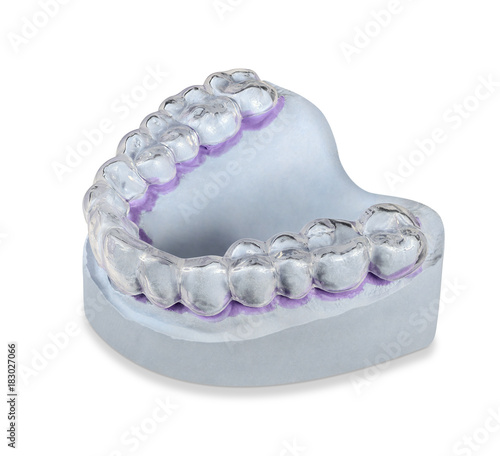 Fertige Zahnschiene auf Gebissabdruck Dentalmodell Stock-Foto | Adobe Stock