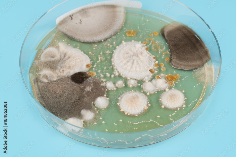 growth of microorganisms in a Petri dish, Bacteria, yeast and mold ...