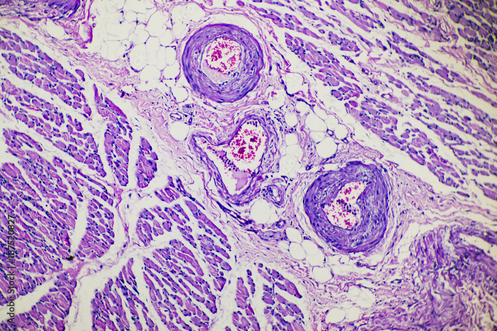 blood vessel in human skeletal muscle Stock Photo | Adobe Stock