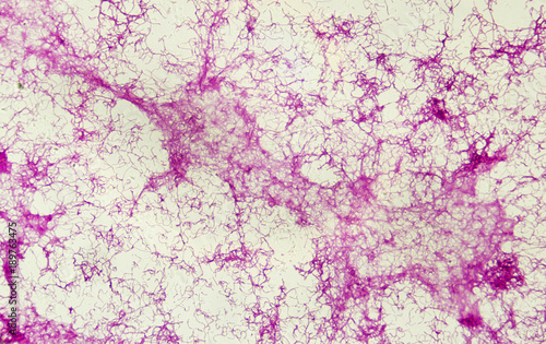 Actinomycetes under the microscope Stock Photo | Adobe Stock