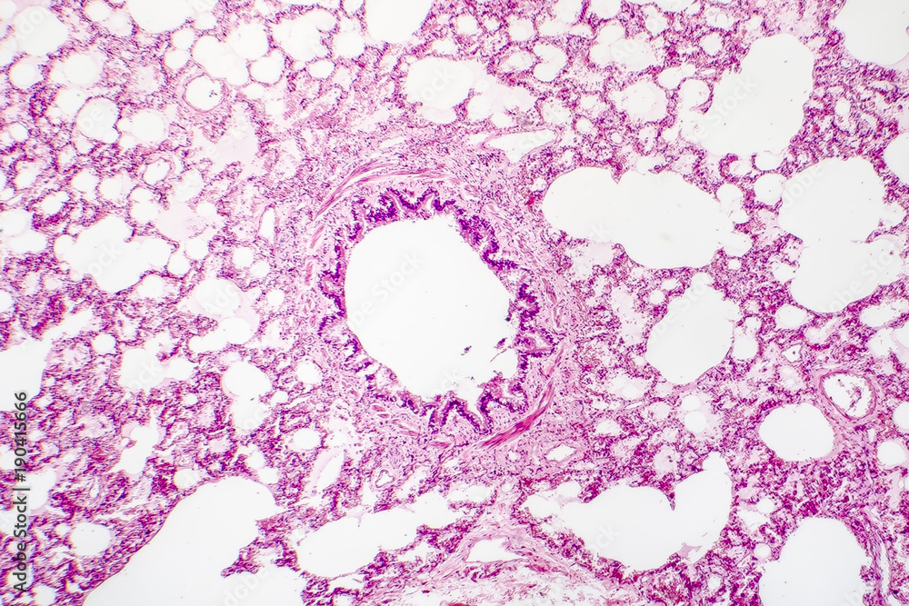 Lung Histology Alveoli