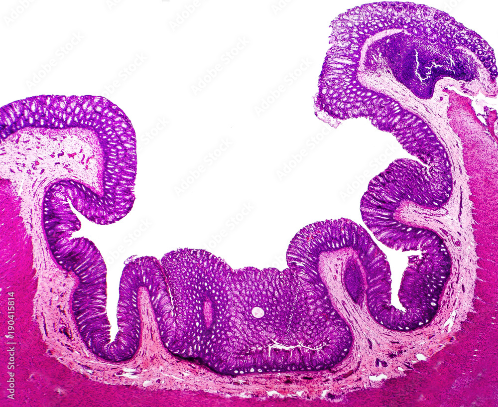 Histology of human appendix, cross-section, micrograph showing ...