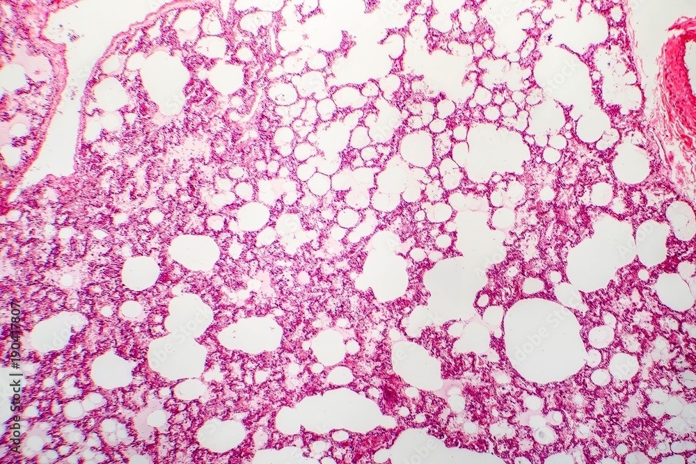 Histology of human lung tissue. Light micrograph showing alveoli, hematoxylin and eosin staining ...