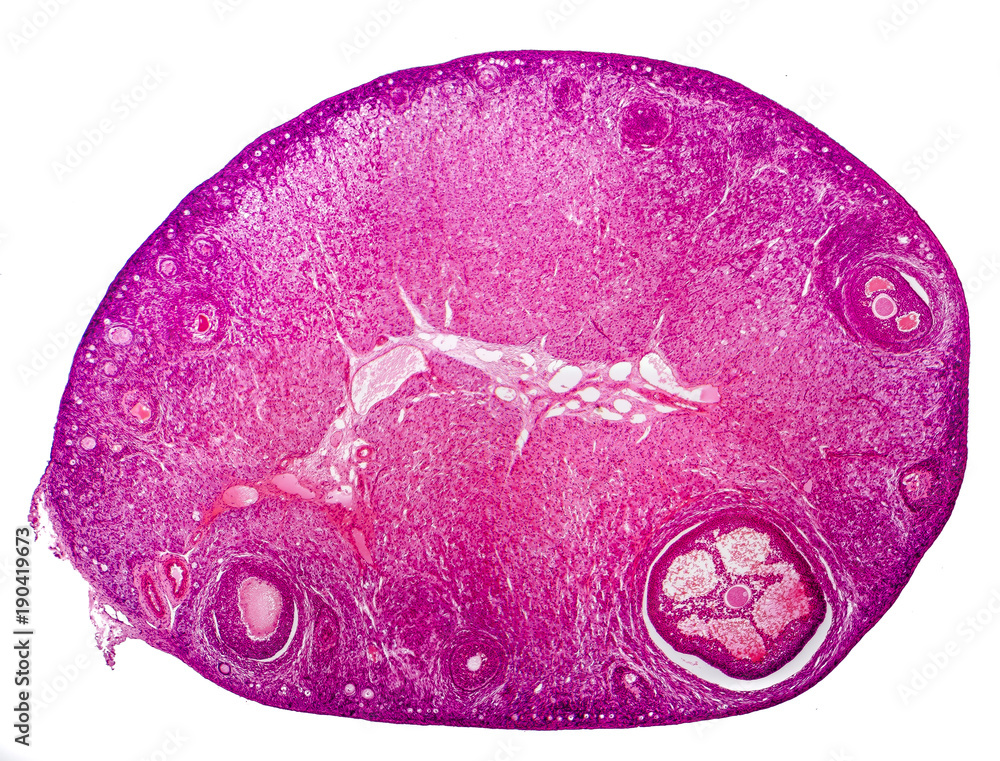 Light micrograph of human ovary showing primordial, primary and ...