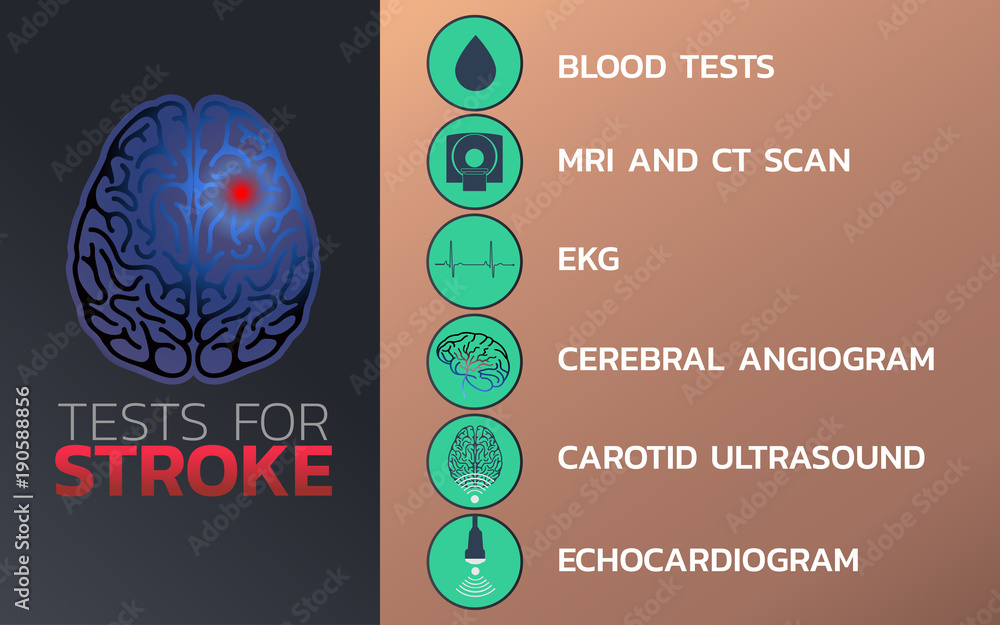 Tests for stroke icon design, infographic health, medical infographic ...