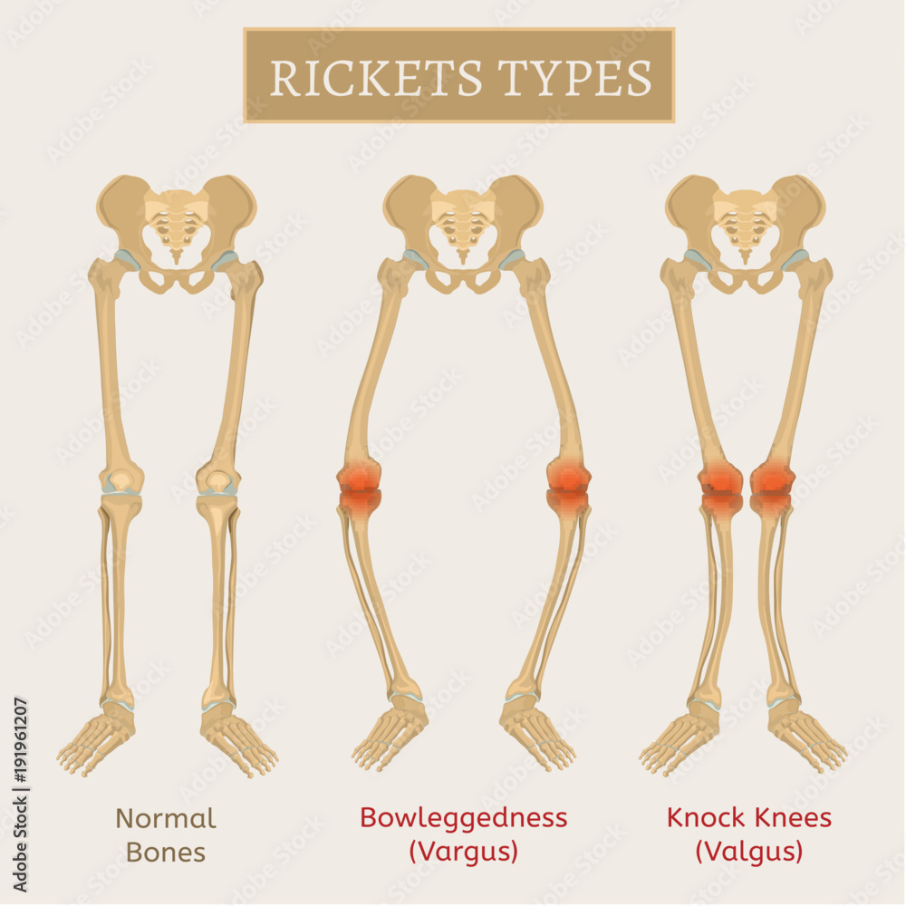 Vector Rickets Scheme Stock Vector | Adobe Stock