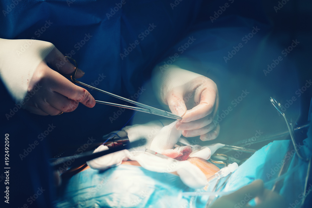 Needle holder or a needle driver in doctor's hand, a surgical ...